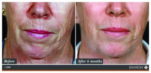 Environ Facials – Rejuven8 Beauty Clinic